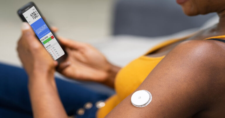Real Time Continuous Glucose Monitoring and SMBG